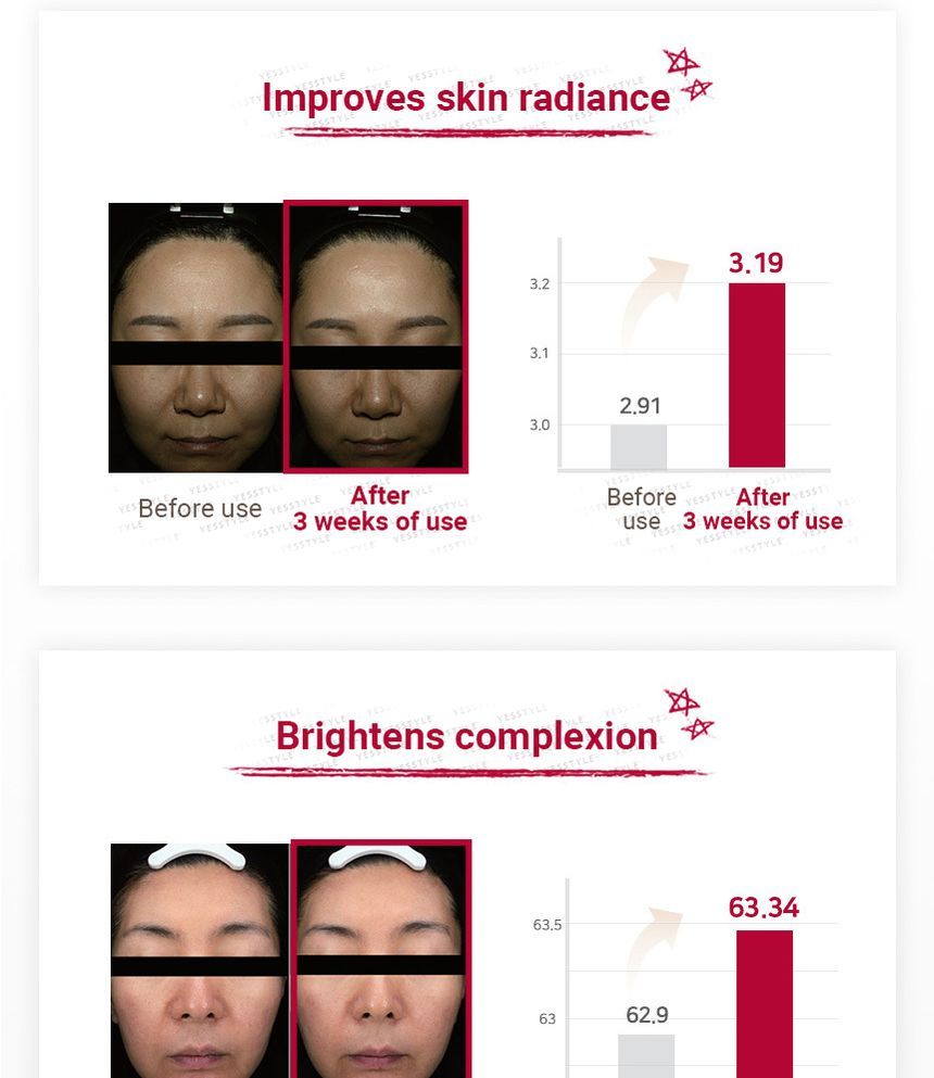 Buy ECLAIR - LED Therapy Mask in Bulk | AsianBeautyWholesale.com