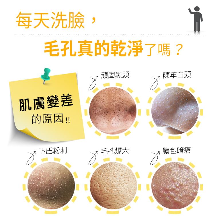 Buy My Scheming - Neo Remover Aloe Blackhead Out 3 Step Mask Pack in ...