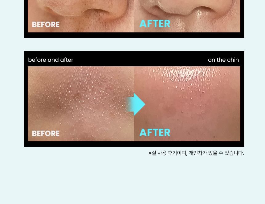 Buy ilso - Super Melting Sebum Softener in Bulk | AsianBeautyWholesale.com