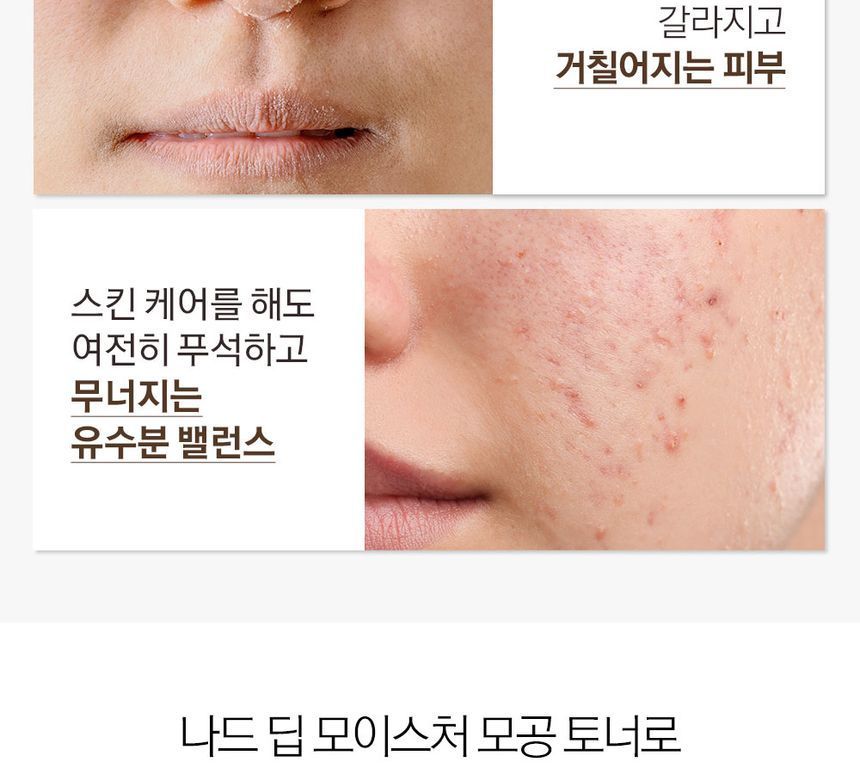 Buy NARD - Deep Moisture Mask Pack Set in Bulk | AsianBeautyWholesale.com