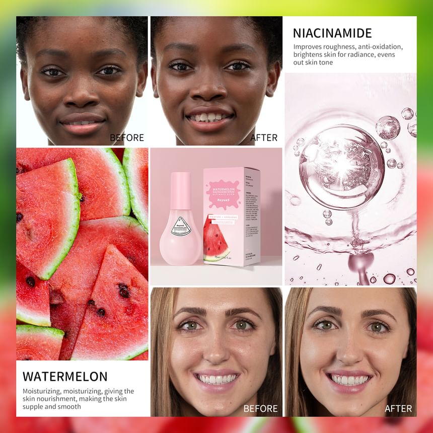 Buy RoyueS - Watermelon Niacinamide Serum in Bulk ...